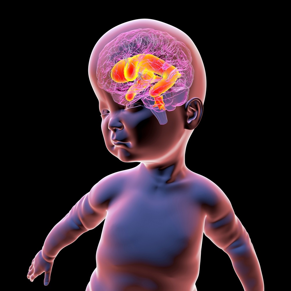 Pediatric Conditions - Sage Brain & Spine